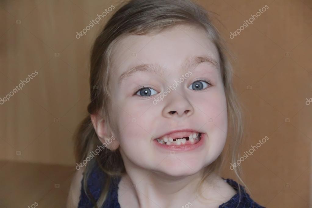 Beautiful child without front teeth — Stock Photo © julialine #22280657