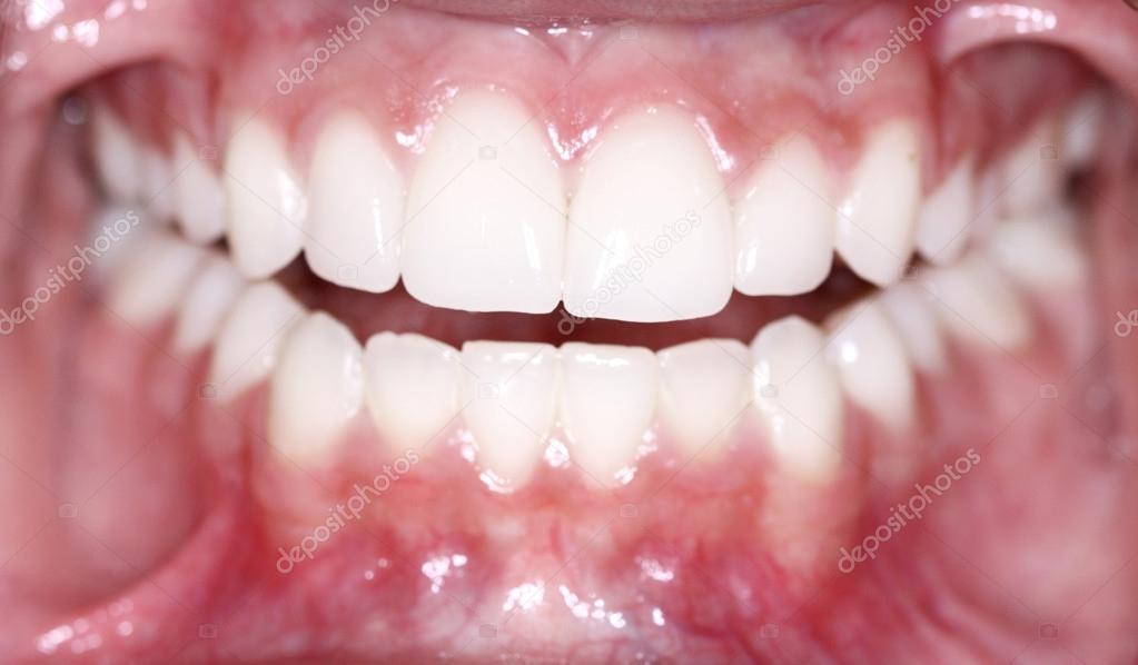 Clean teeth — Stock Photo © EnginKorkmaz #19843395