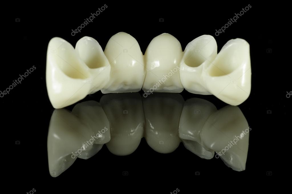 Dental Bridge Stock Photo by ©bgbs 28084313