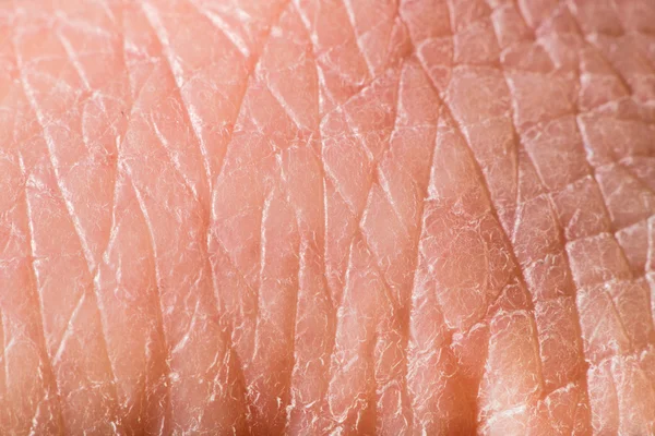 Texture of human skin — Stock Photo © deyangeorgiev2 #38668015