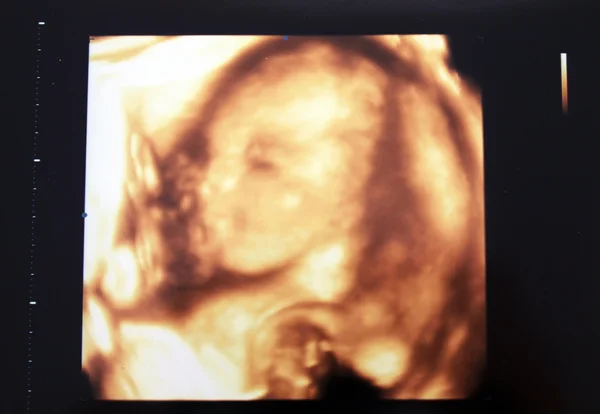 4d scan Stock Photos, Royalty Free 4d scan Images | Depositphotos