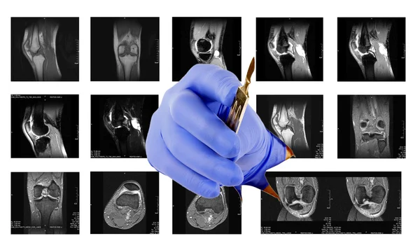 Gonarthrosis Stock Photos, Royalty Free Gonarthrosis Images ...
