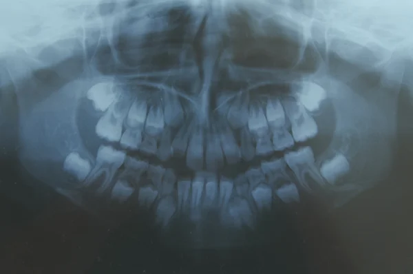 Radiographia Stock Photos, Royalty Free Radiographia Images | Depositphotos