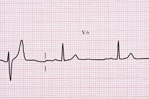 Heart diagram Images - Search Images on Everypixel