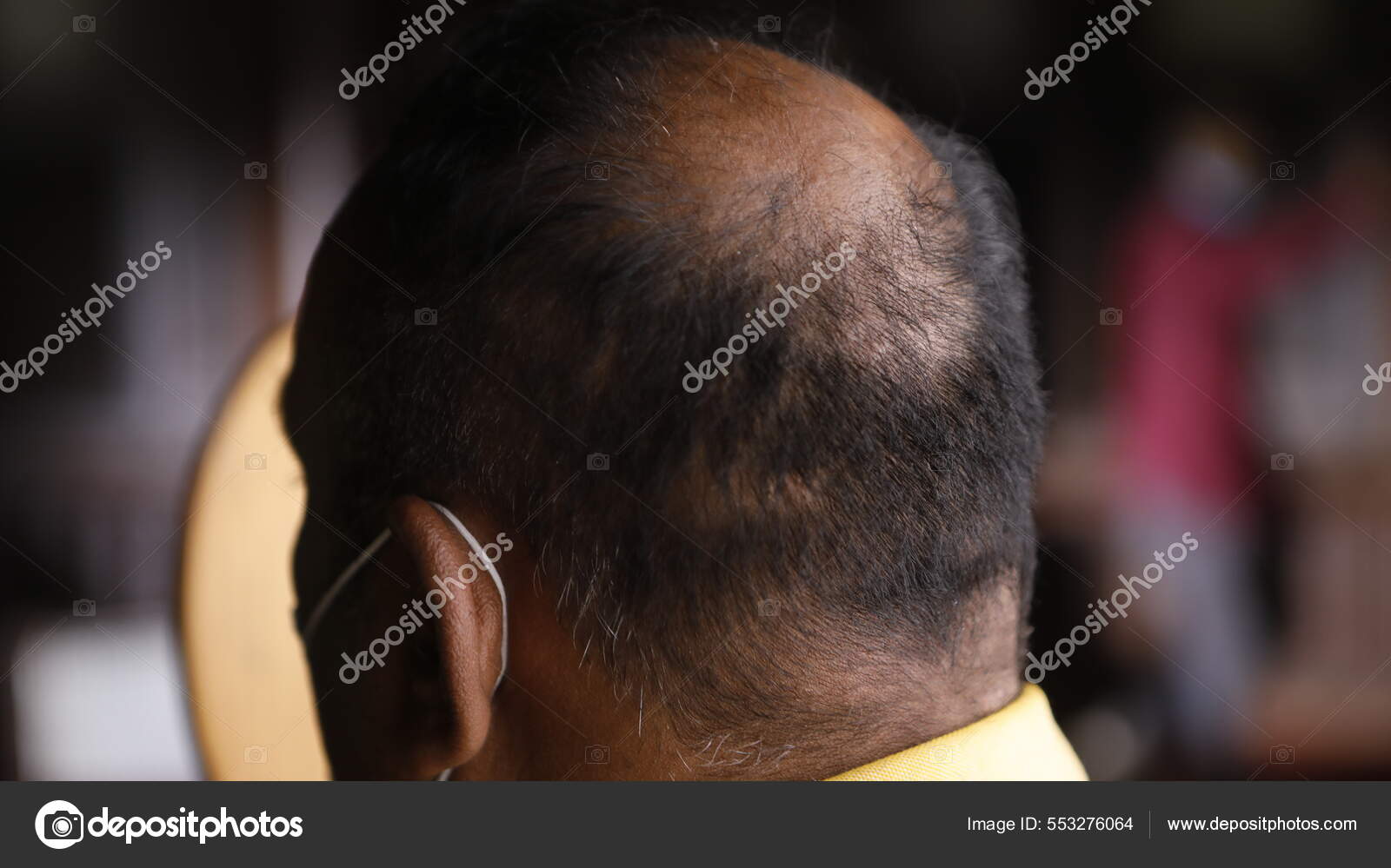 Rear View Bald Head Man — Stock Photo © rajastills #553276064 Rear View Bald Head Man — Stock Photo © rajastills #553276064