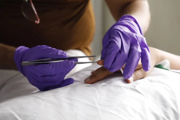 Skin grafting Stock Photos, Royalty Free Skin grafting Images ...