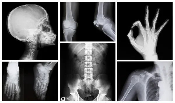 Xray Stock Photos, Royalty Free Xray Images | Depositphotos