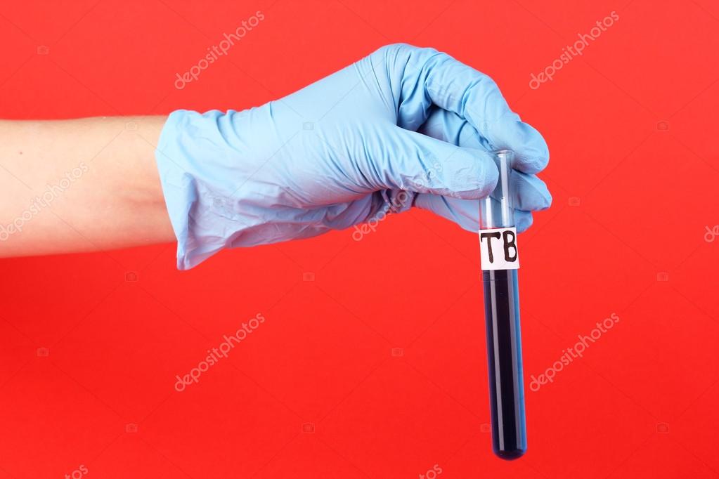 Test tube labeled Tuberculosis(TB) in hand on red background Stock ...