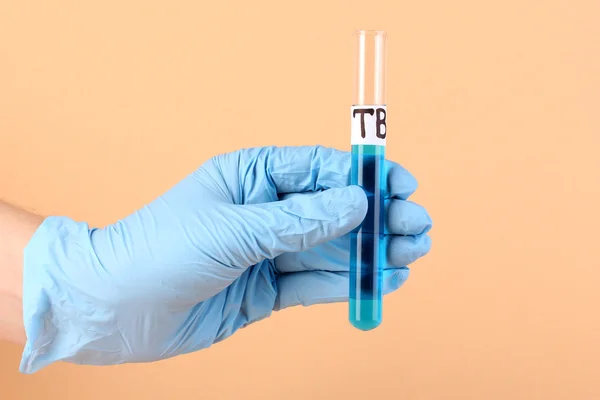 Test tube labeled Tuberculosis(TB) in hand on red background Stock ...