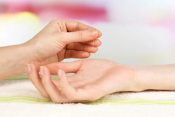 Acupuncture hand Stock Photos, Royalty Free Acupuncture hand Images ...