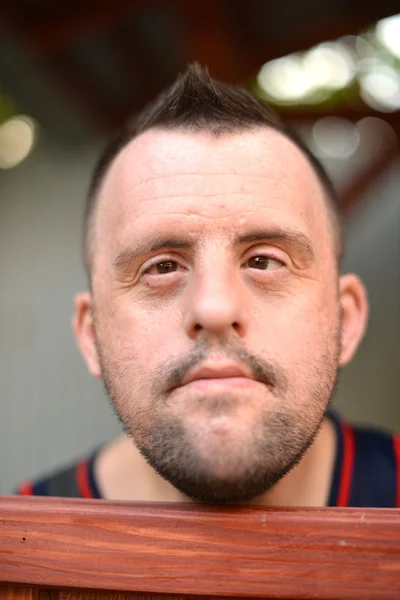 Hombre con síndrome de Down: fotografía de stock © muro #9172665 ...