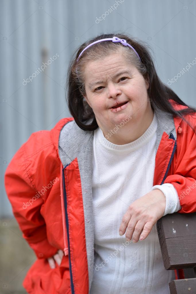 Woman with down syndrome Stock Photo by ©muro 43398453