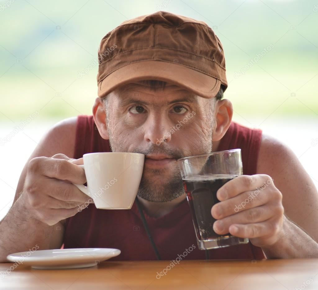 Man with down syndrome Stock Photo by ©muro 50206717