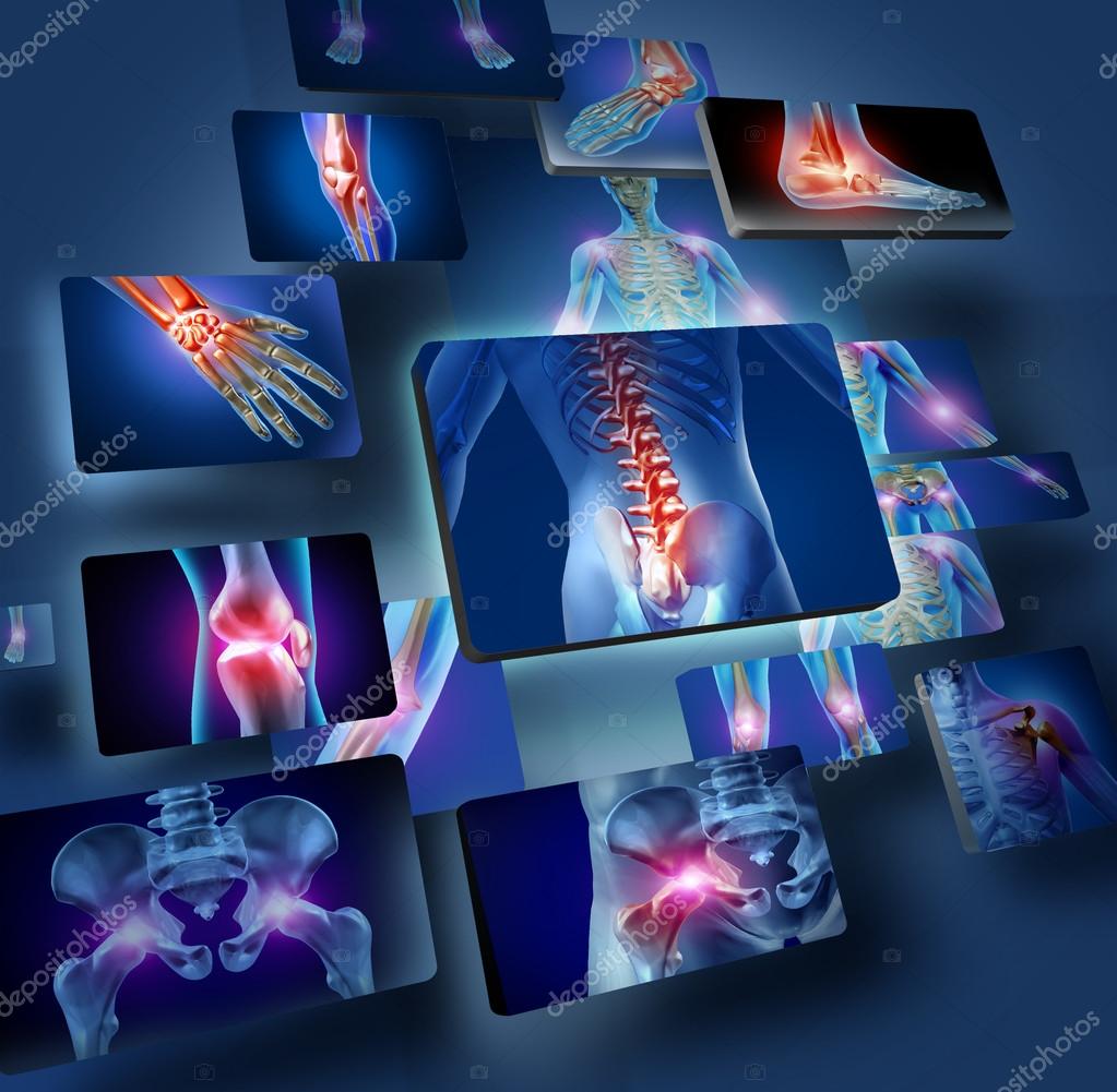 Human Joints Concept Stock Photo by ©lightsource 19543787