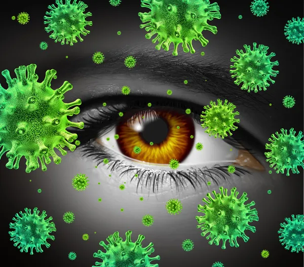 Infection oculaire images libres de droit, photos de Infection oculaire ...