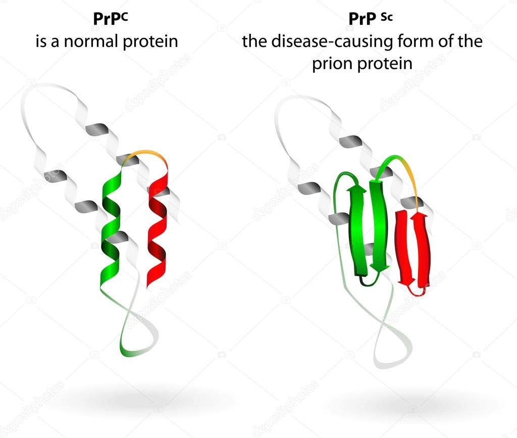 Normal protein and prion diseases. Vector scheme — Stock Vector ... Normal protein and prion diseases. Vector scheme — Stock Vector ...