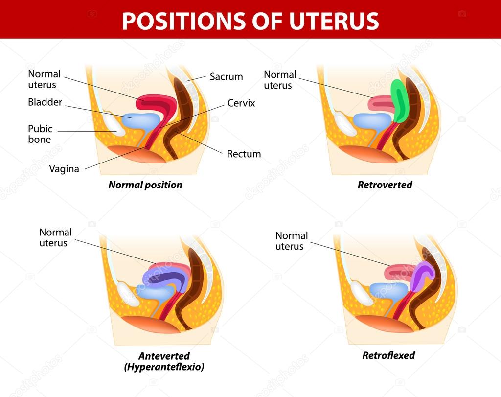 Positions Of Uterus — Stock Vector © Edesignua 37255493
