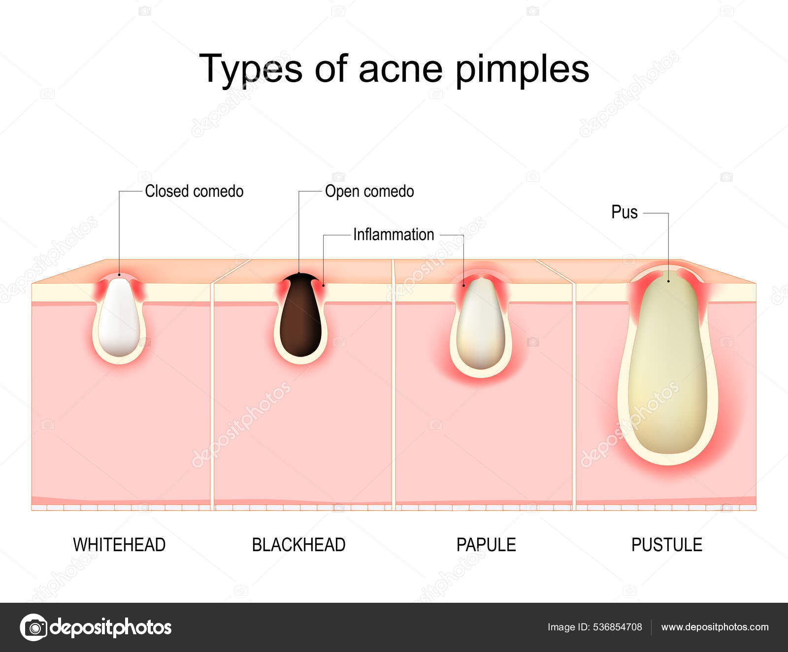 Dukker Kviser Diagram