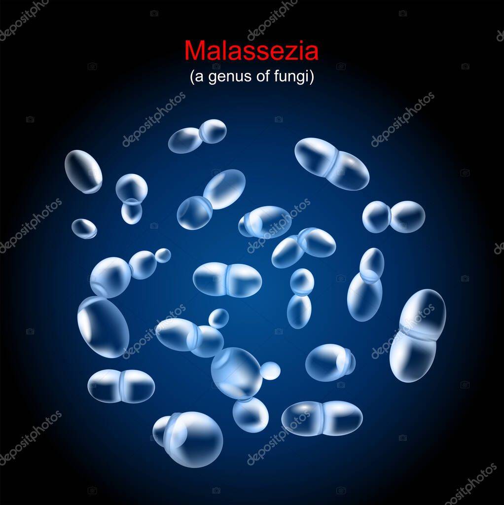Malassezia. hongo que causó de tiña versicolor, pitiriasis y otras ...