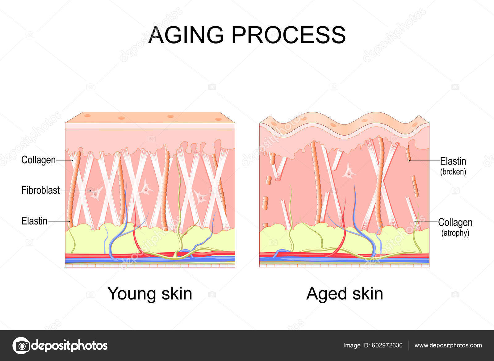 Aging Process Comparison Young Aged Skin Collagen Elastin Fibroblasts ...