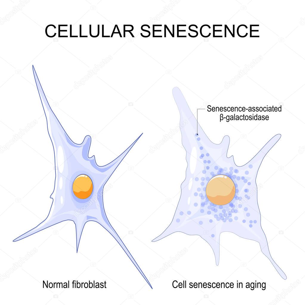 Cellular senescence. changes senescent cells During ageing. Comparison and difference between ...