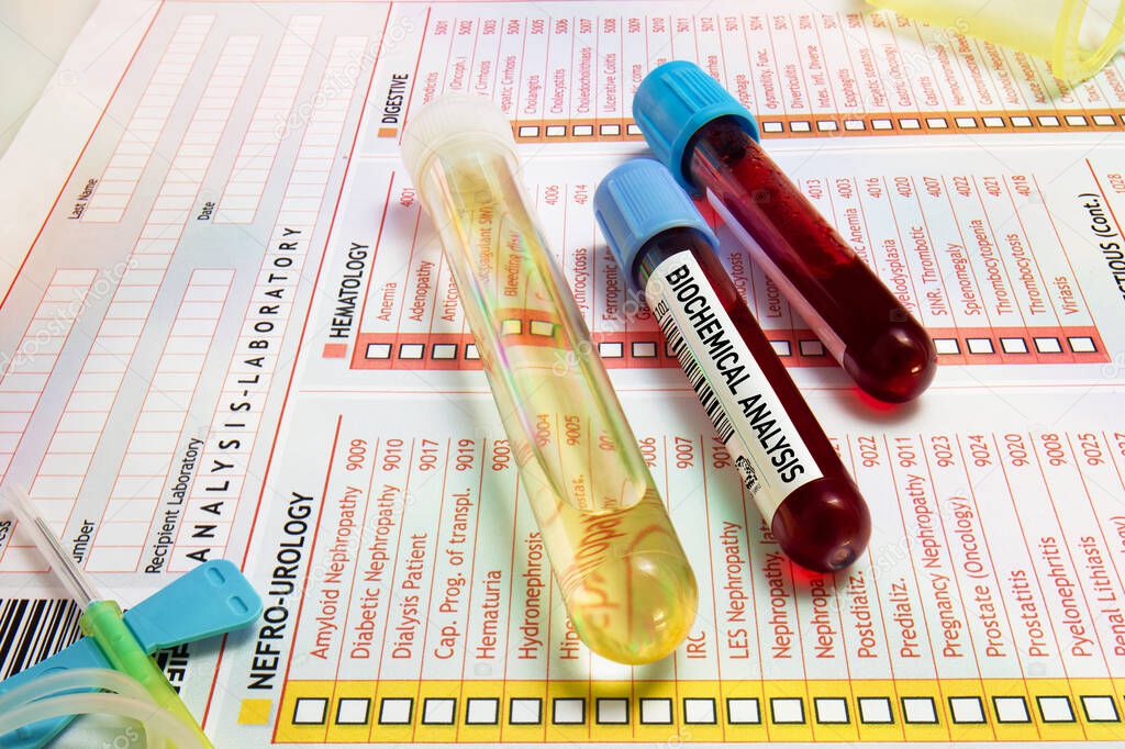 Tubos Muestras biológicas de un paciente para análisis bioquímico con ...