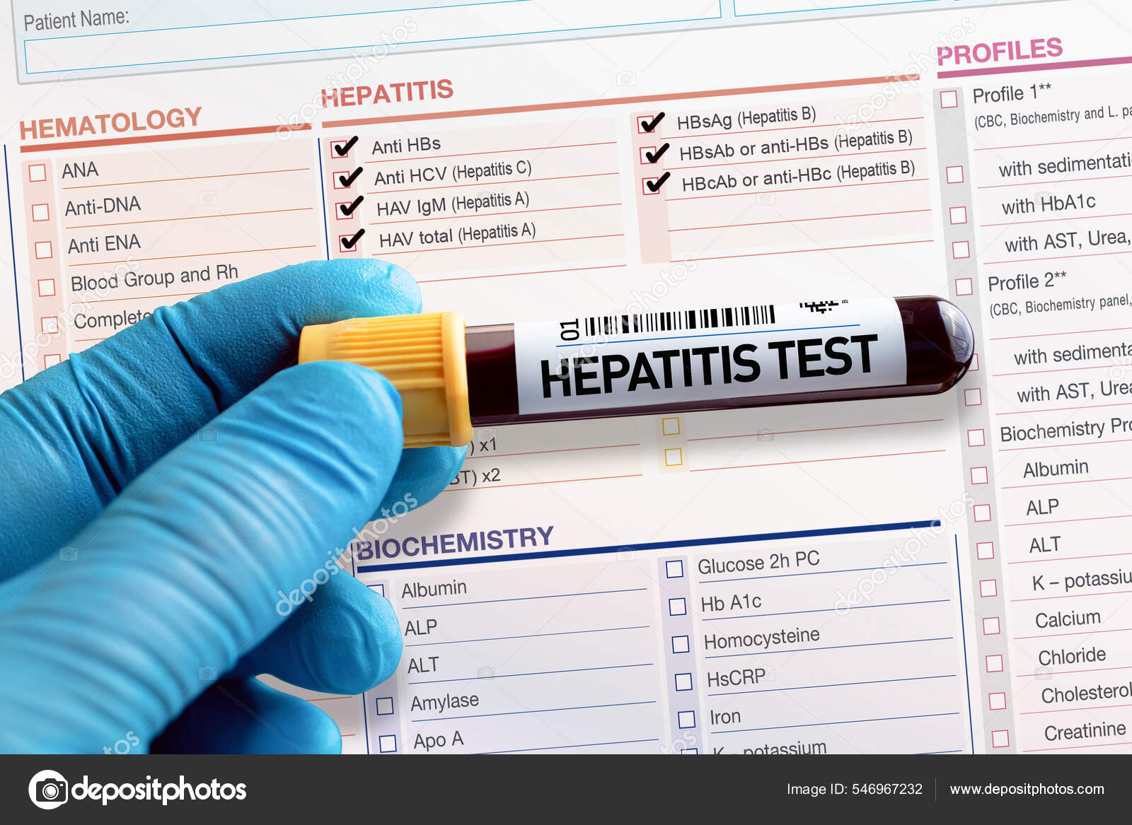 Blood Sample Tube Analysis Hepatitis Disease Laboratory Blood Tube Test ...