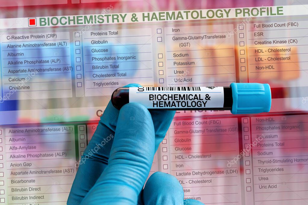 Tubo de muestra de sangre para análisis de bioquímica y prueba de ... Tubo de muestra de sangre para análisis de bioquímica y prueba de ...