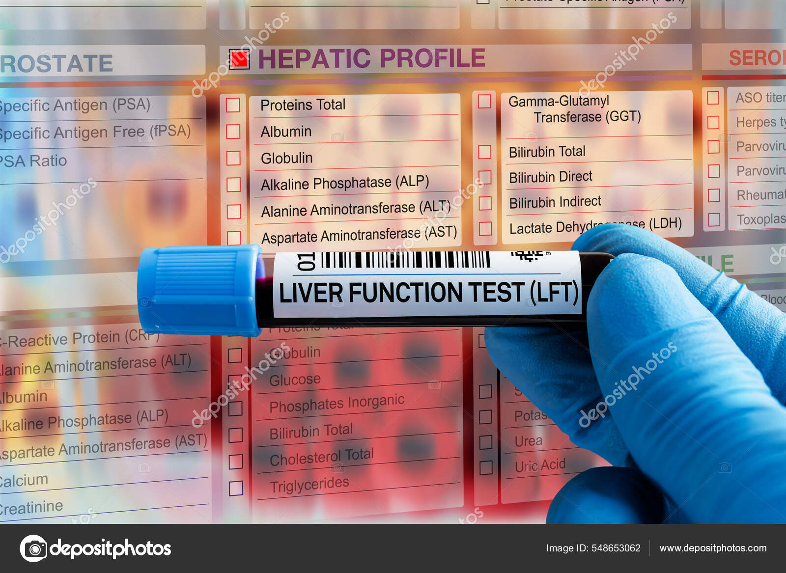 Tubo Muestra Sangre Para Análisis Prueba Función Hepática Chequeo Lft ...