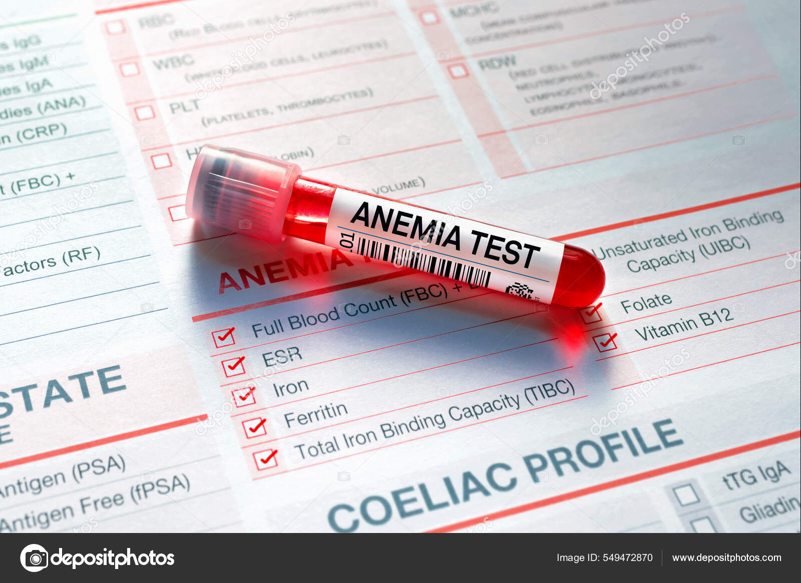 Blood Tube Test Requisition Form Anaemia Test Blood Sample Analysis ...
