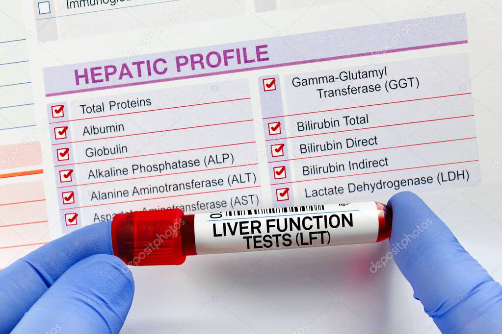 Tubo de muestra de sangre para análisis de LFT Pruebas de función ...
