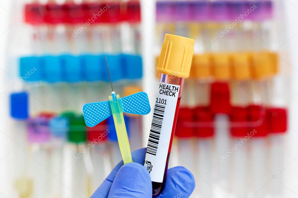 Muestra de sangre del paciente para examen básico y chequeo de salud en ...