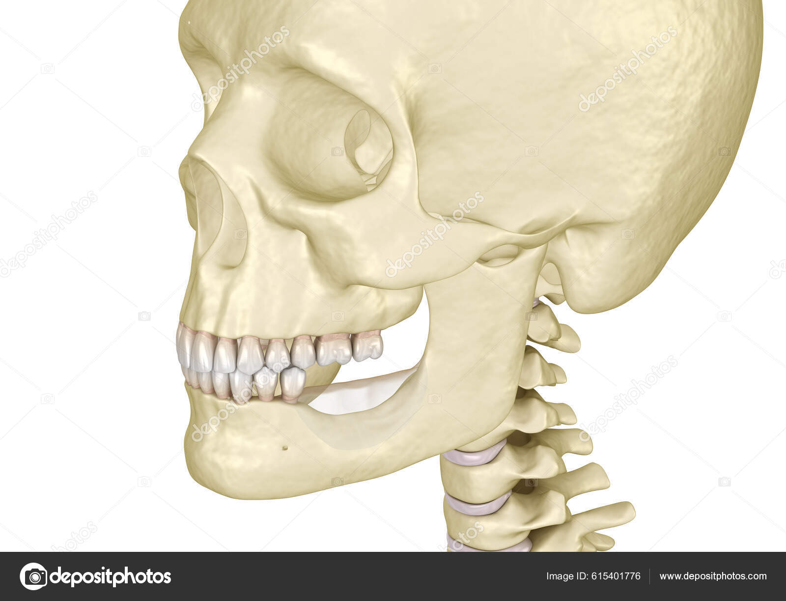 Mandibular Jaw Bone Recession Losing Molars Teeth Medically Accurate ...