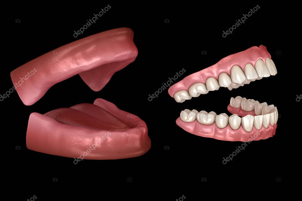 Prótesis maxilar y mandibular, dentaduras artificiales. Ilustración 3D ...