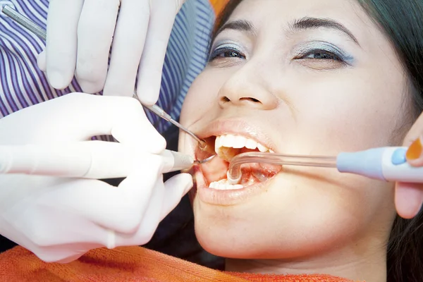 Asiático dentista mostrar dentes aparelho na clínica — Fotografia de ...