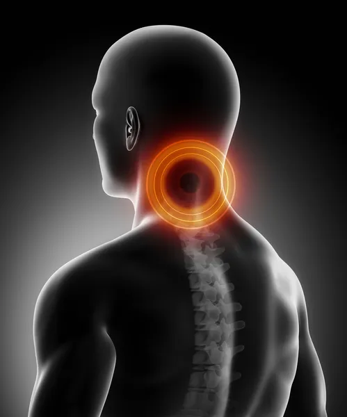 Cervical pain Images - Search Images on Everypixel