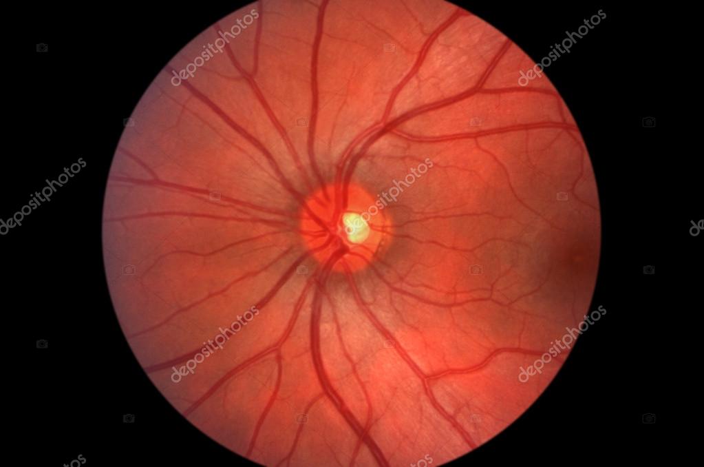 Human Retina - Optic Nerve — Stock Photo © lightscribe #16307939