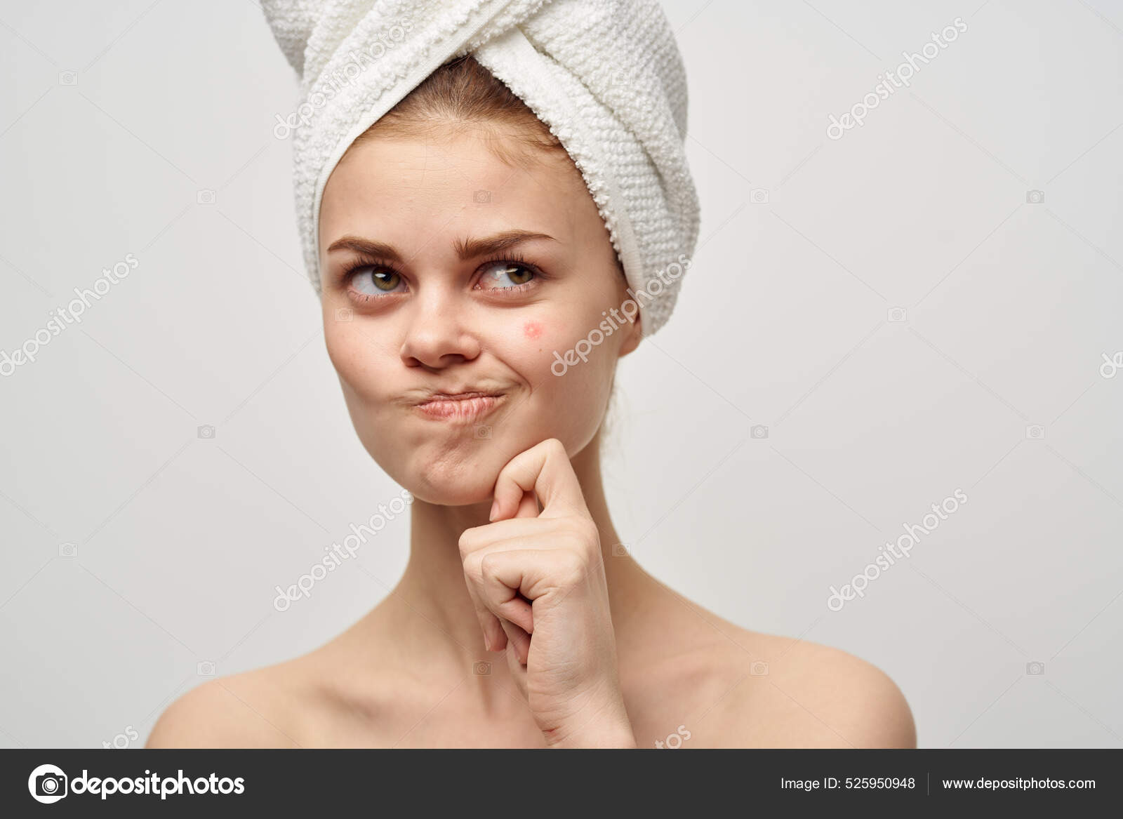 Woman Pimple Fac Close High Quality Photo — Stock Photo © ShotStudio ...