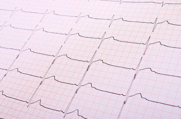 Diagramme du rythme cardiaque images libres de droit, photos de ...