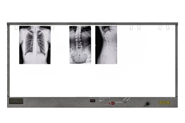 Pie de rayos x Stock Photos, Royalty Free Pie de rayos x Images ...