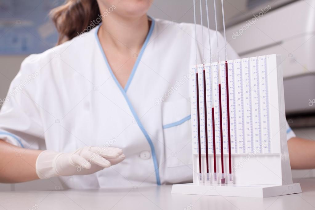 Woman doctor doing erythrocyte sedimentation rate test Stock Photo by ...