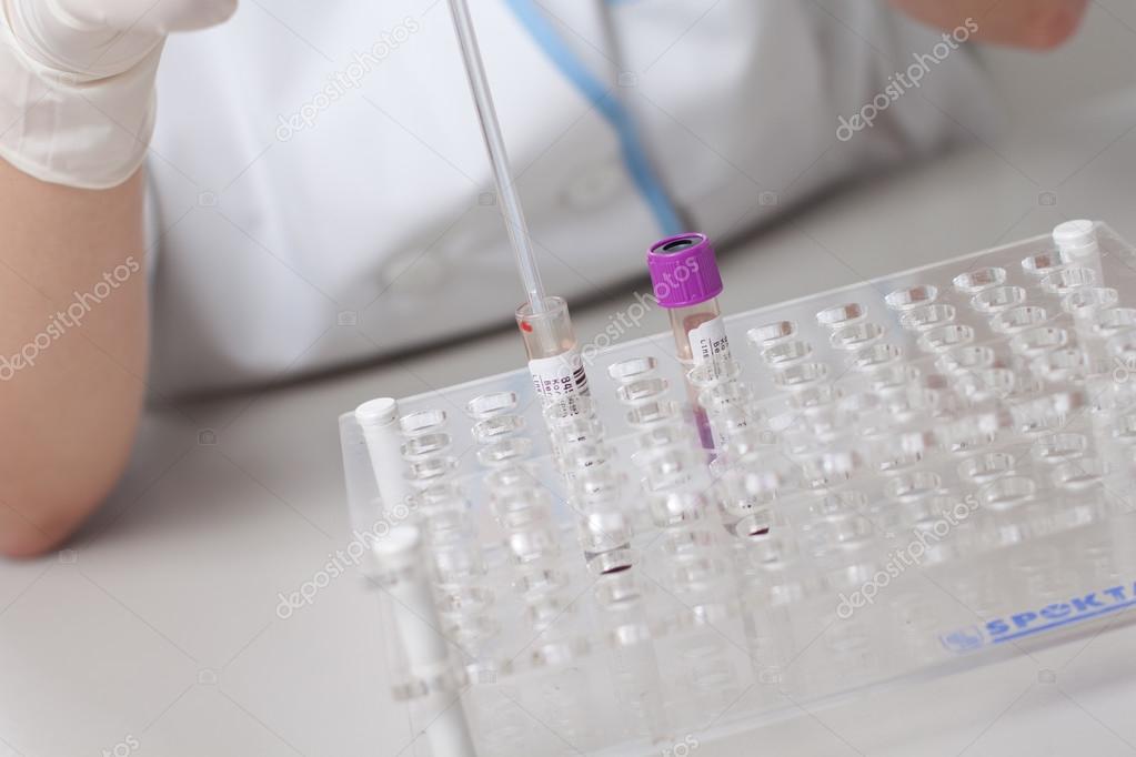 Woman doctor doing erythrocyte sedimentation rate test — Stock Photo ...