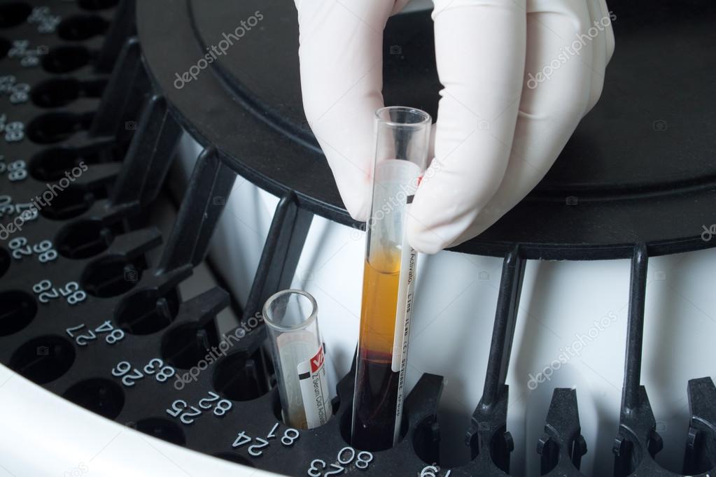 Woman loading samples in analyzer Stock Photo by ©alexhg1 22614377