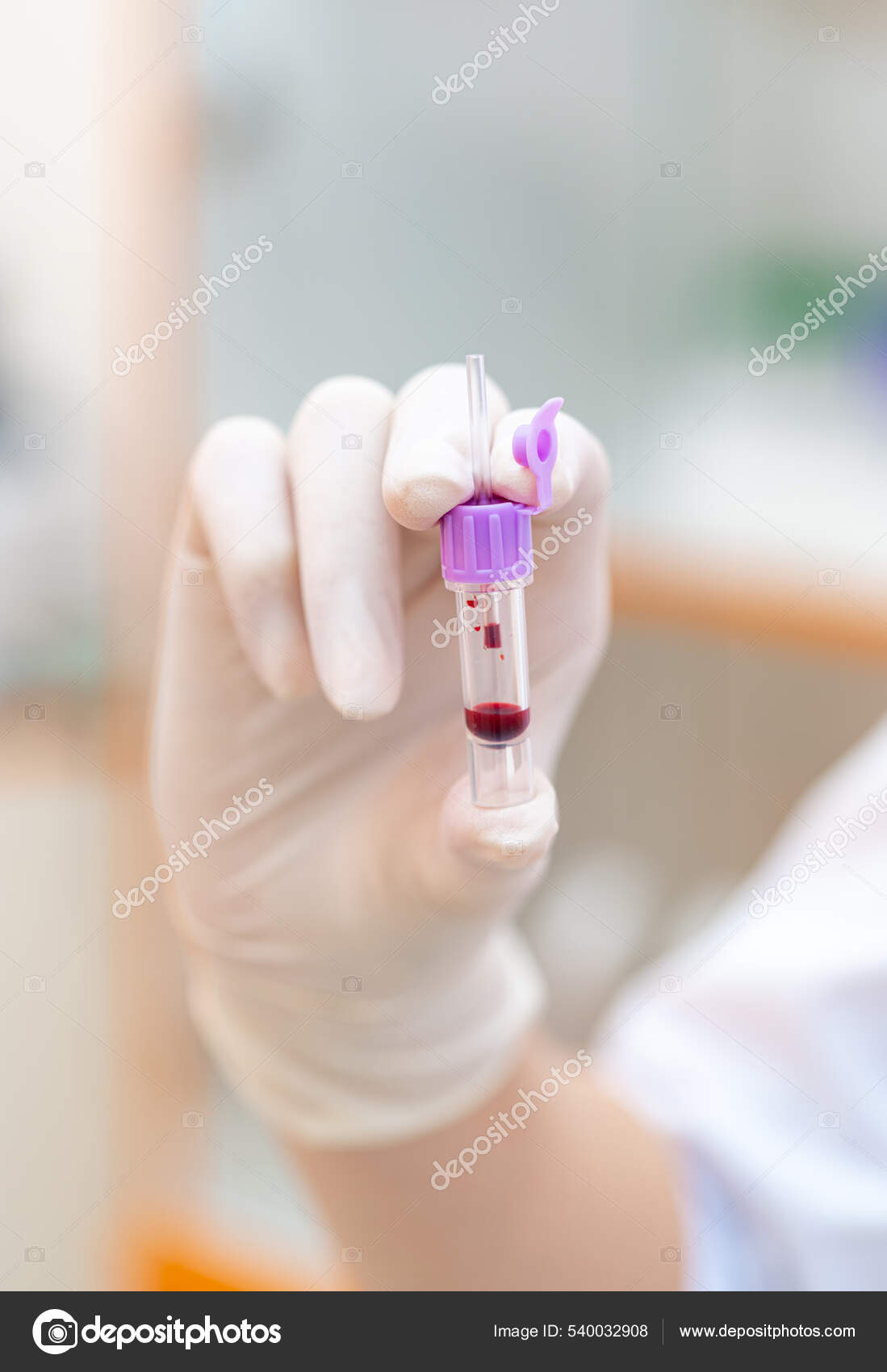 Blood Tube Hands Test Analysis Laboratory Hematology Illness Diagnosing ...