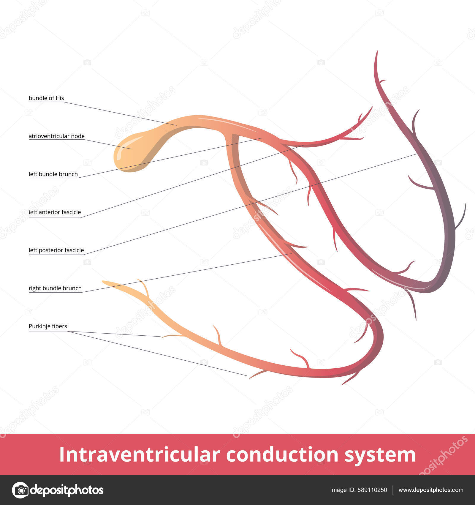 Sistema Conducción Intraventricular Sistema Conducción Intraventricular ...