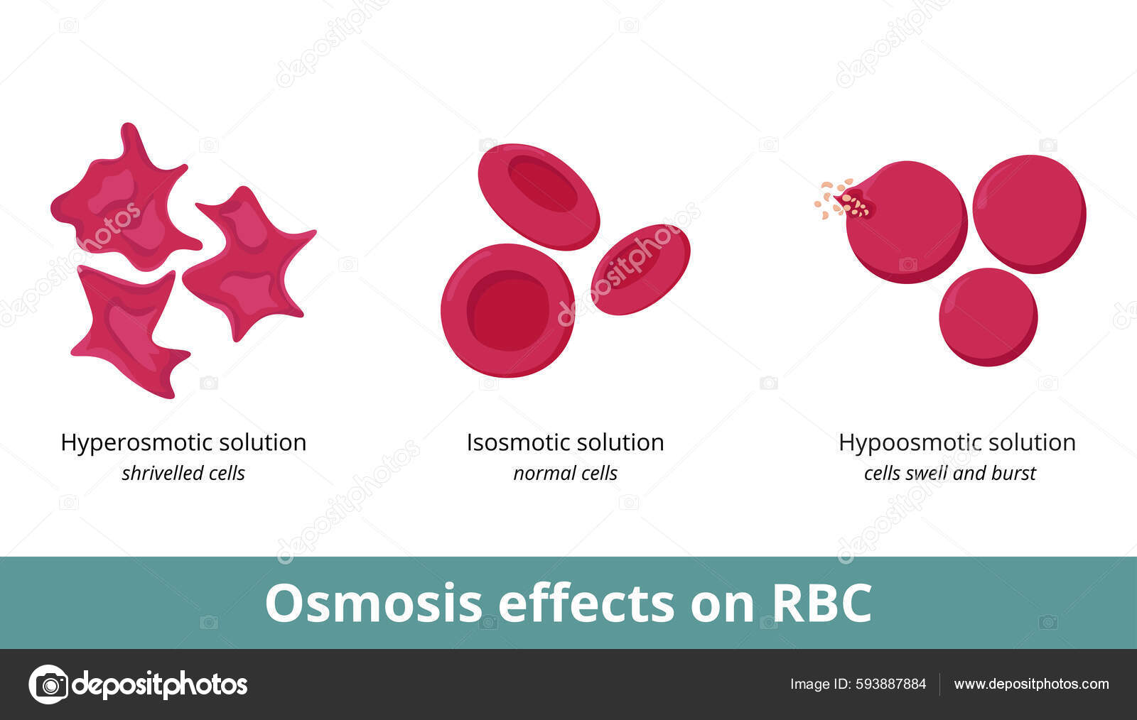 Osmosis Effect Red Blood Cells Depending Solution Concentration Hyperosmotic Isosmotic vector ...