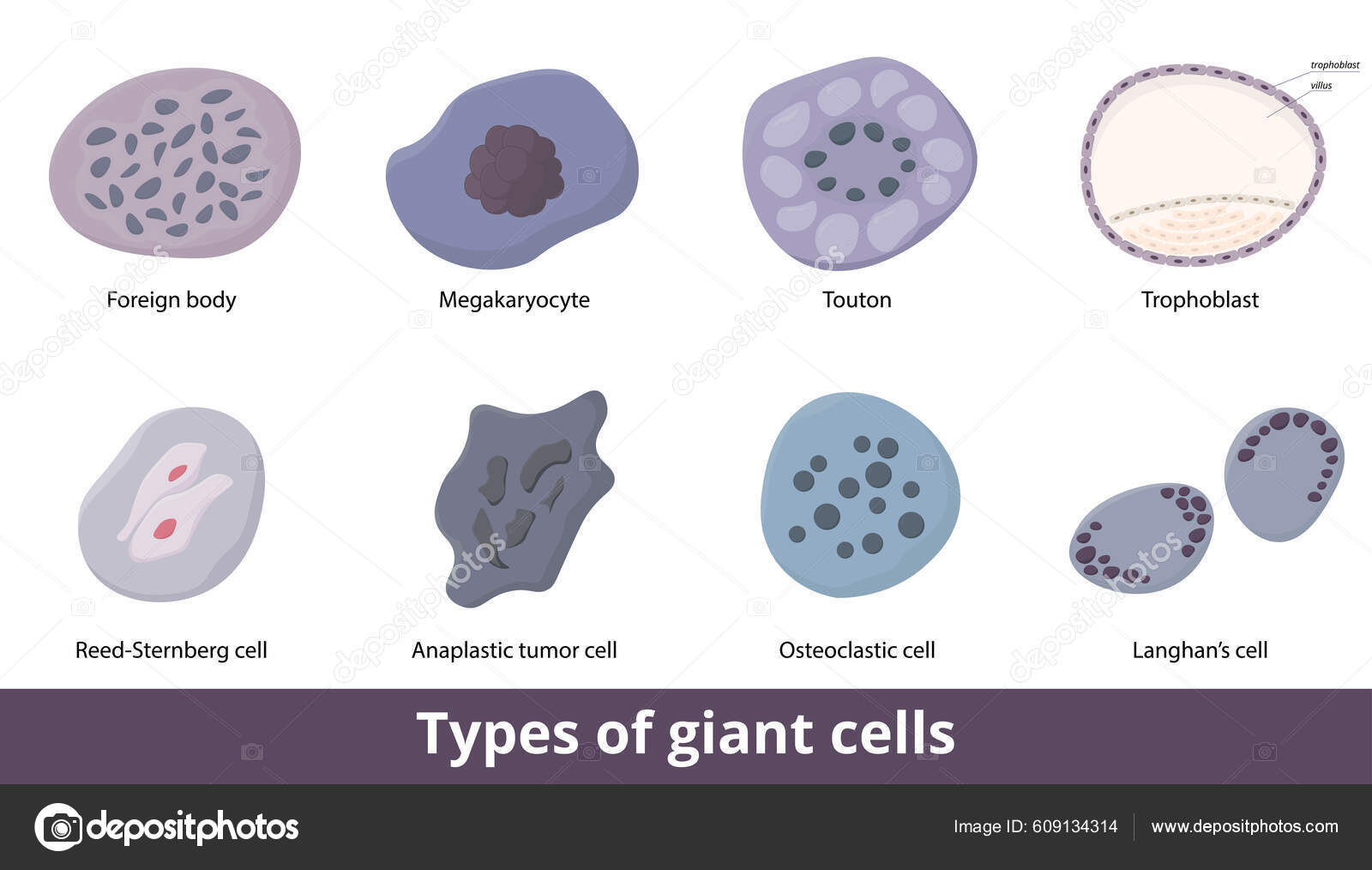 Tipos Células Gigantes Oito Tipos Células Gigantes Incluem Langhan ...