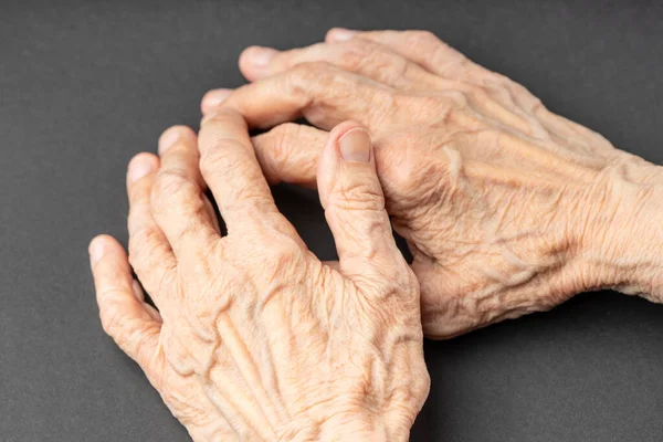 Old Wrinkled Hands Veins Closeup — Stock Photo © Varavin88 #534468448