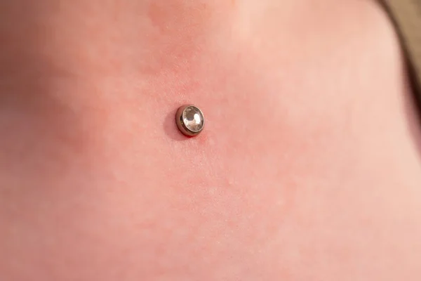 Dermal Piercing Chest Infection
