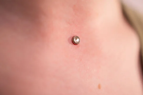 Microdermal Stock Photos, Royalty Free Microdermal Images | Depositphotos